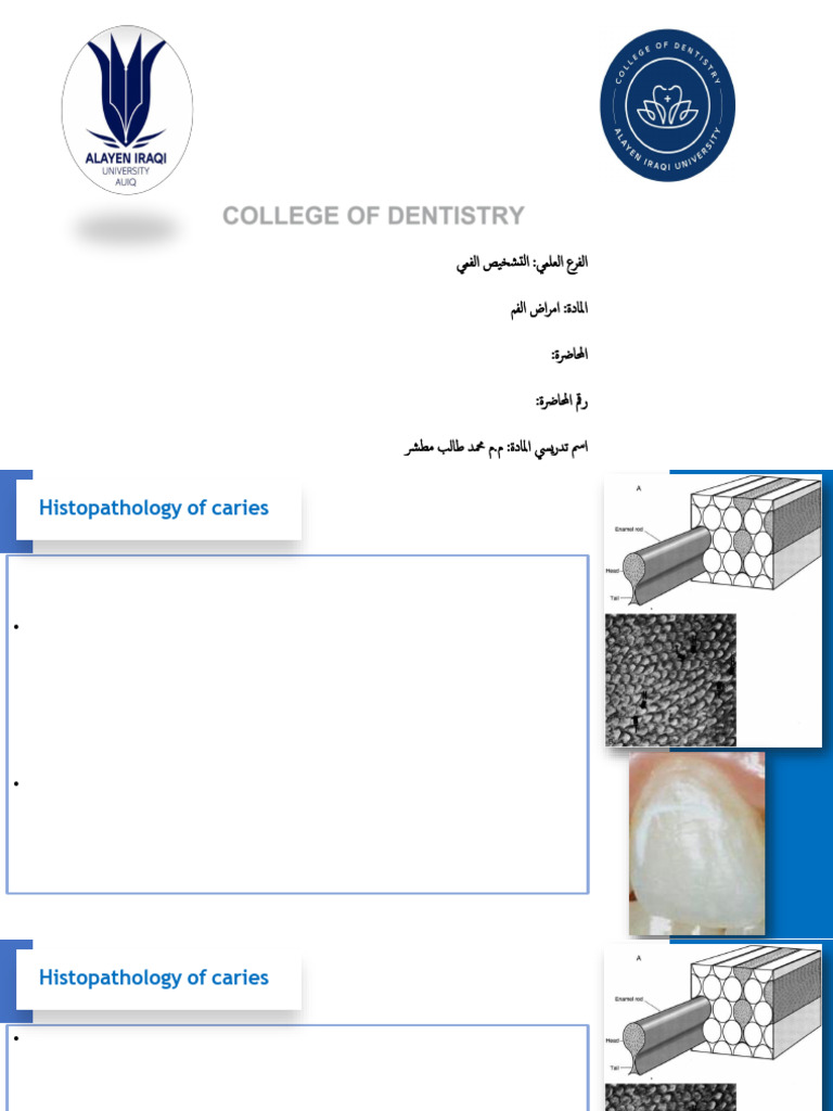 Oral Patho Lec.3 Dental Caries p.2 | PDF | Dentin | Tooth Enamel
