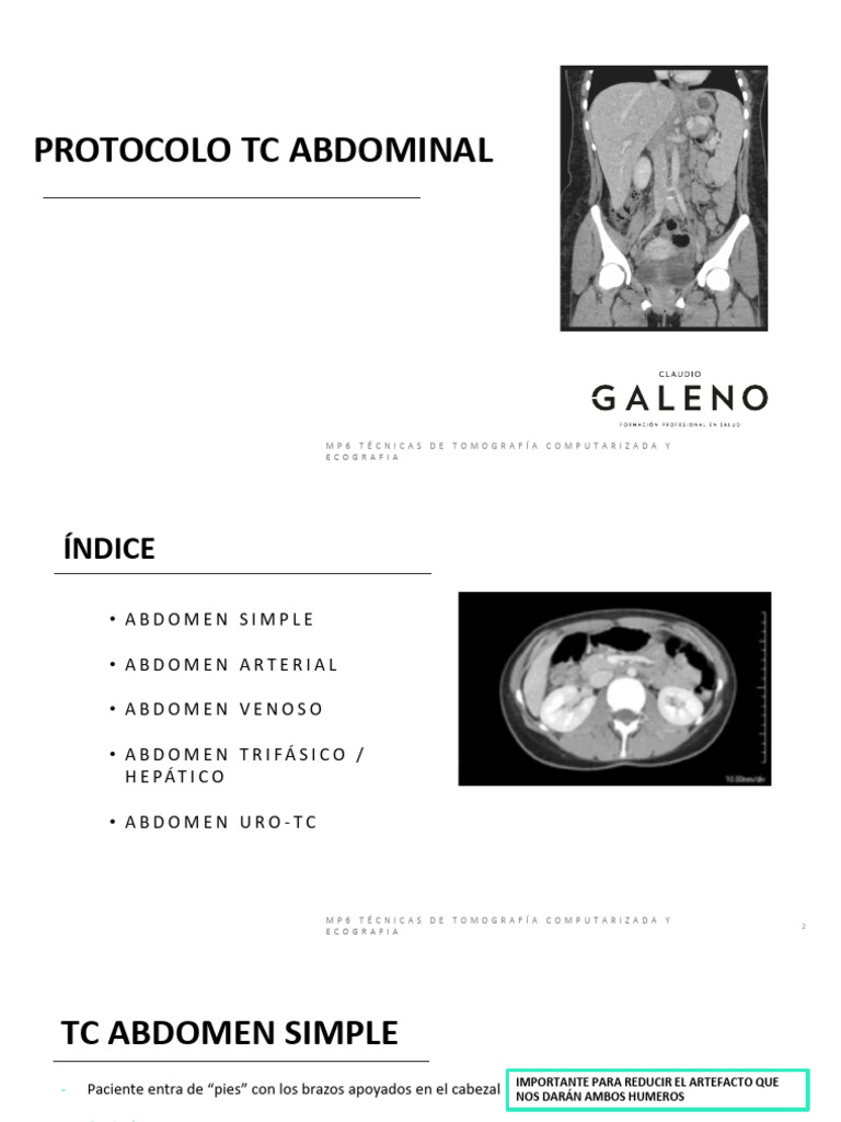 T8-Protocolo TC Abdominal | PDF | Ct Scan | Abdomen