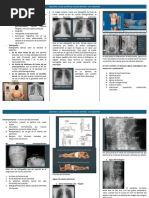 Signos de neumoperitoneo en radiografías | PDF | Abdomen | Hígado