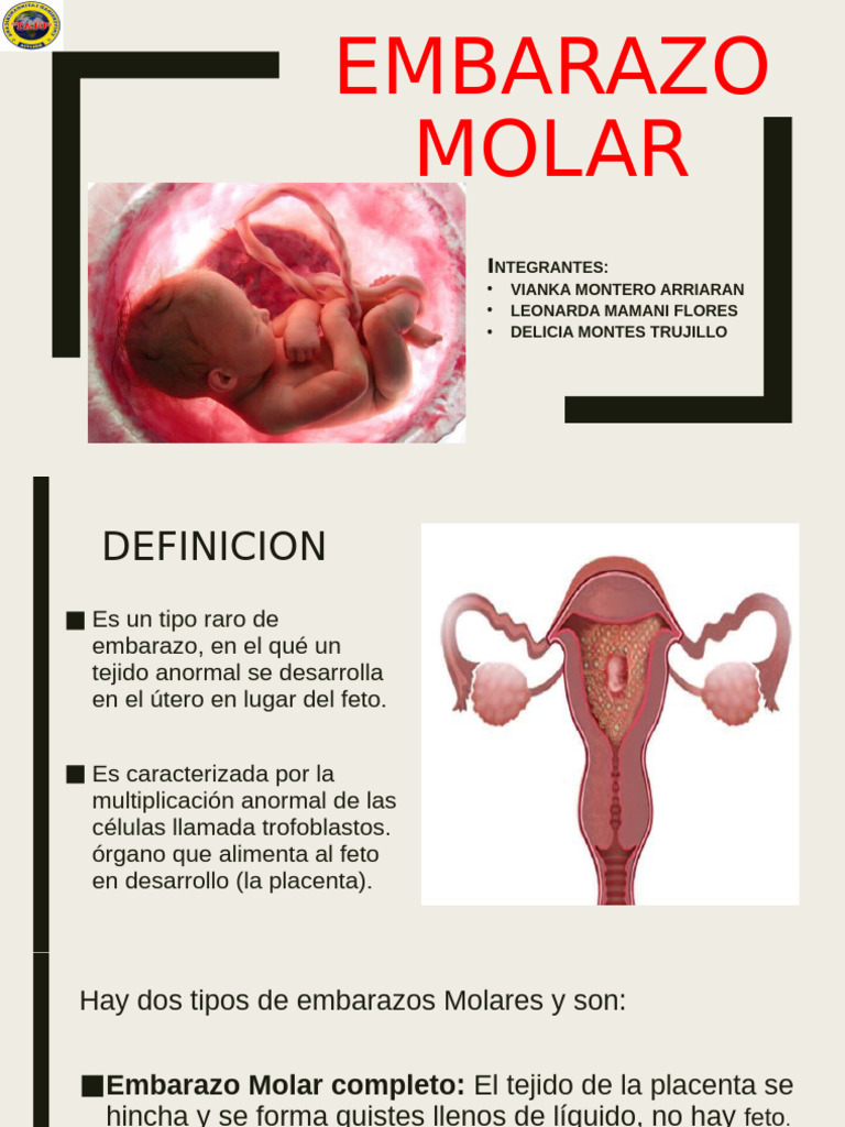 Embarazo Molar | PDF | El embarazo | Placenta