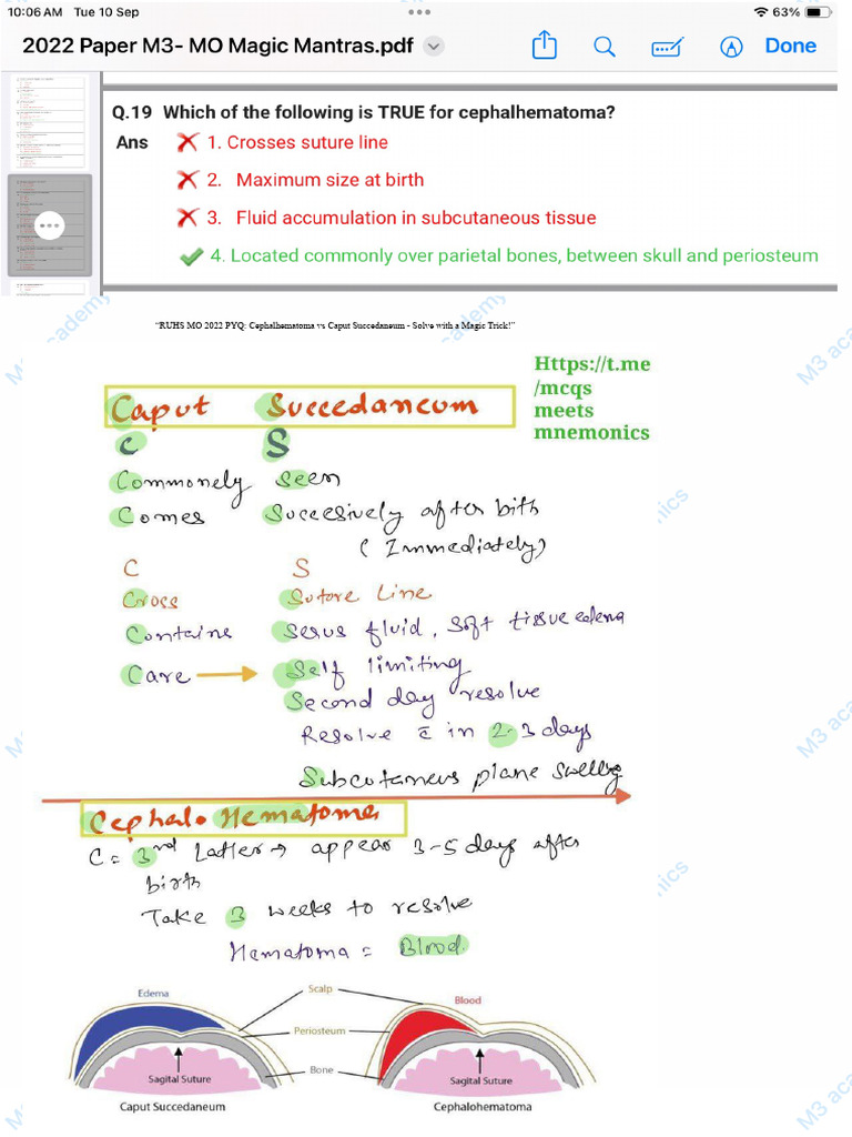 PDF "RUHS MO 2022 PYQ Cephalhematoma Vs Caput Succ 240910 174355 | PDF ...