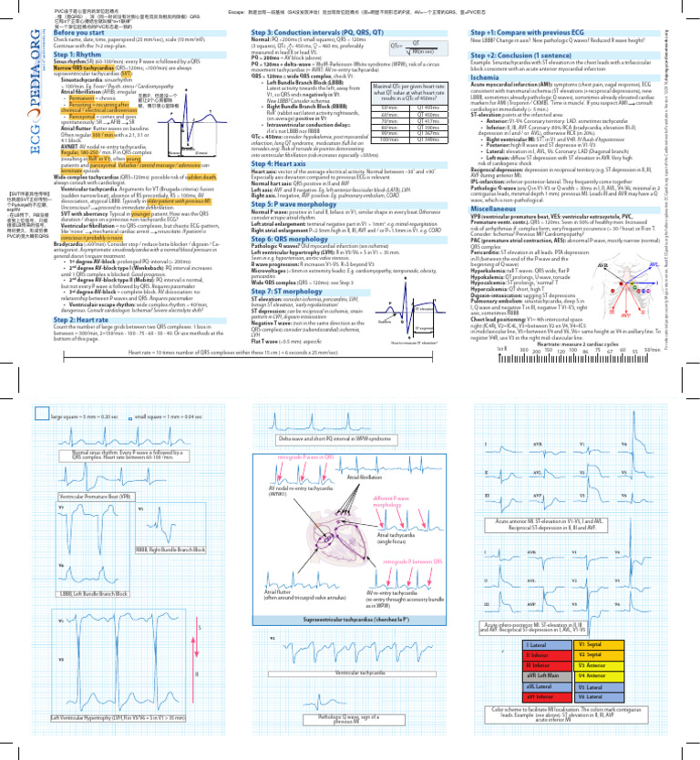 ECGpedia On 1 A4En | PDF | Electrocardiography | Myocardial Infarction