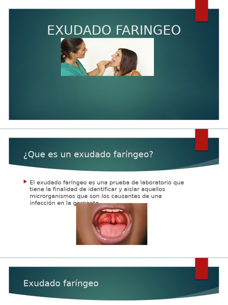 Exudado Faringeo | PDF | Salud y bienestar