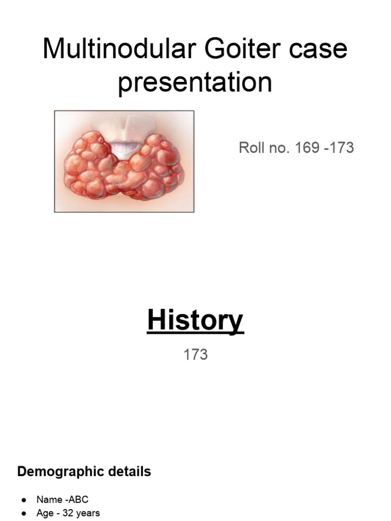 Multinodular Goitre | PDF | Medical Specialties | Clinical Medicine