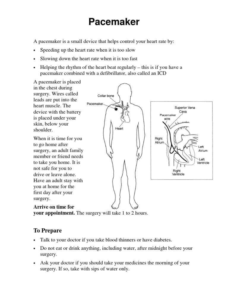 Pacemaker | Artificial Cardiac Pacemaker | Heart