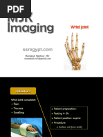 TFCC Lesions: Classification Guide | PDF | Joints | Human Anatomy