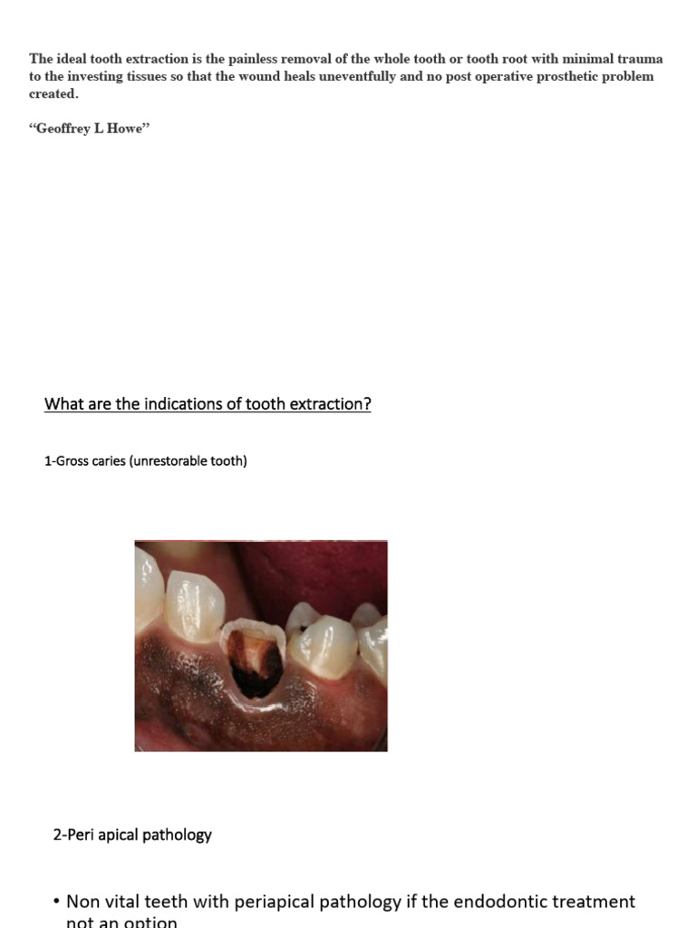 Tooth Extraction: Indications & Contraindications | PDF | Causes Of ...