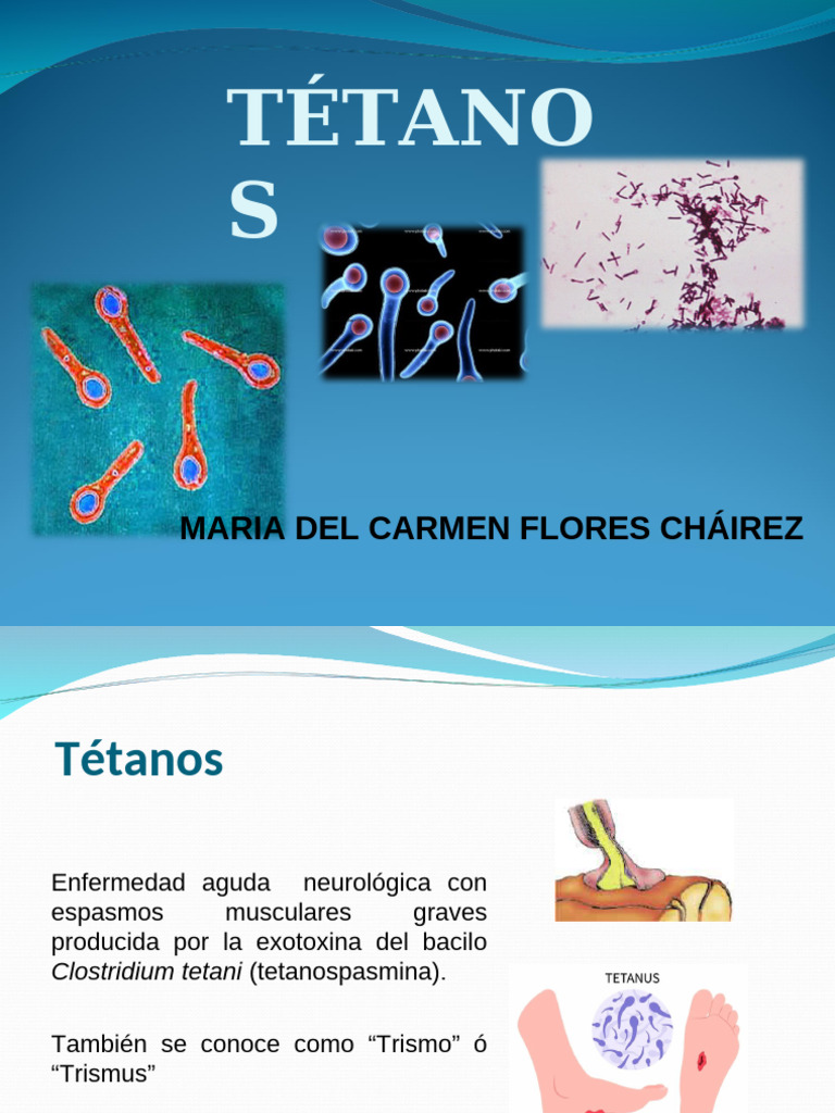 Tétanos: Causas, Síntomas y Prevención | PDF | Especialidades Medicas | Medicina CLINICA