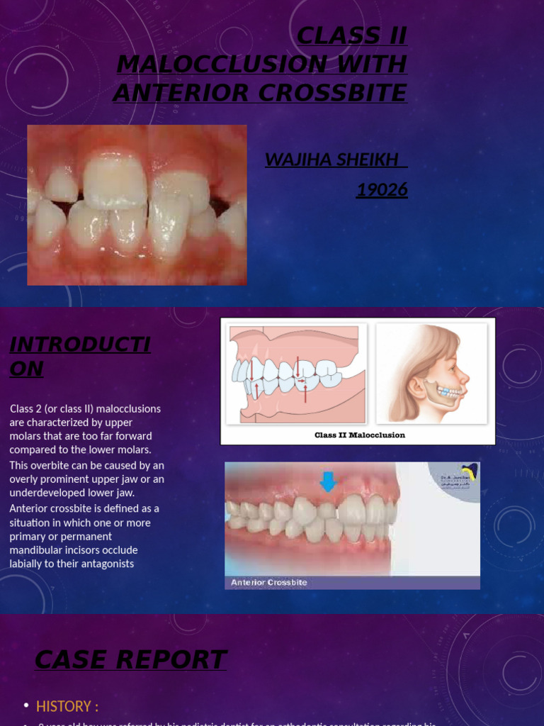 Class 2 With Ant Crossbite | PDF | Dentistry Branches | Dental Anatomy