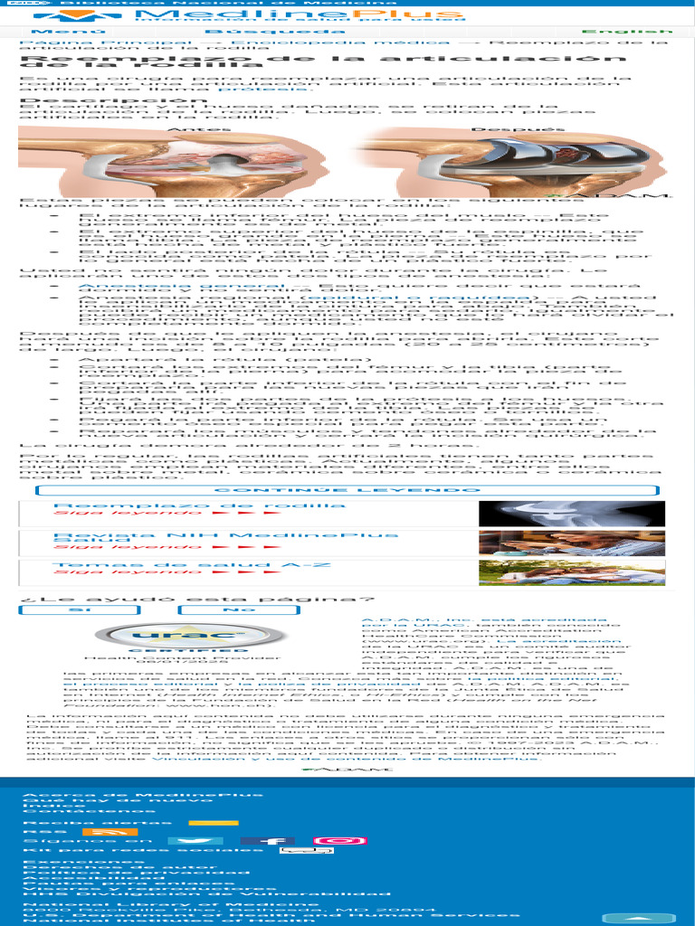 Reemplazo de La Articulación de La Rodilla MedlinePlus Enciclopedia ...