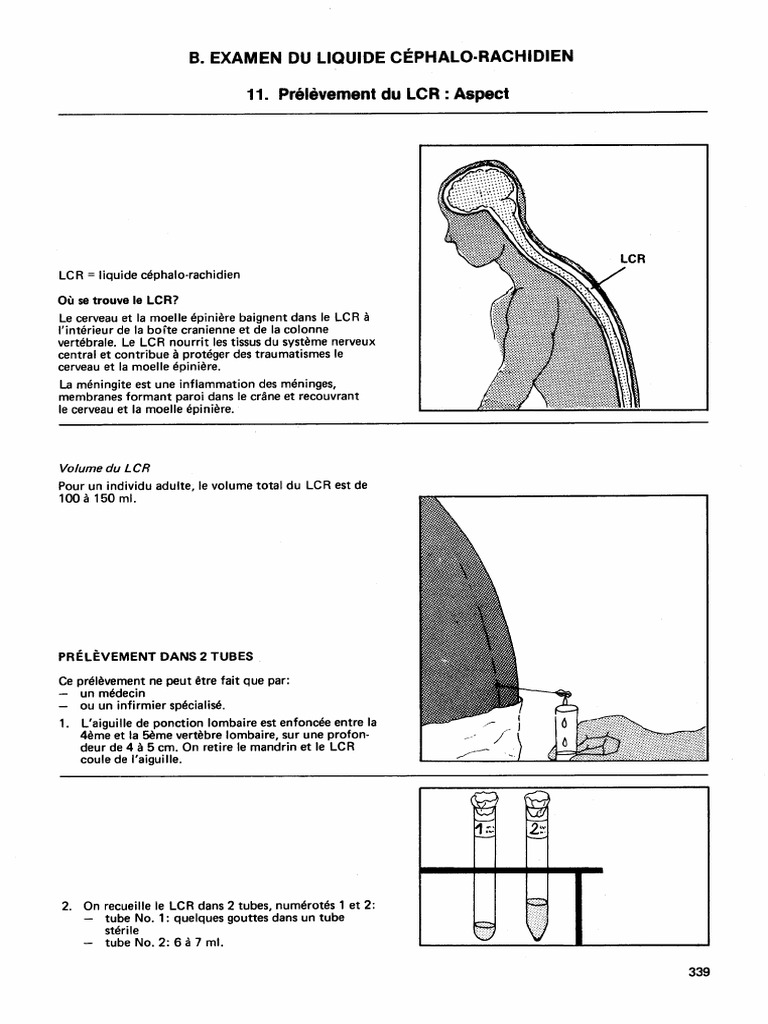 Examen Du LCR | PDF