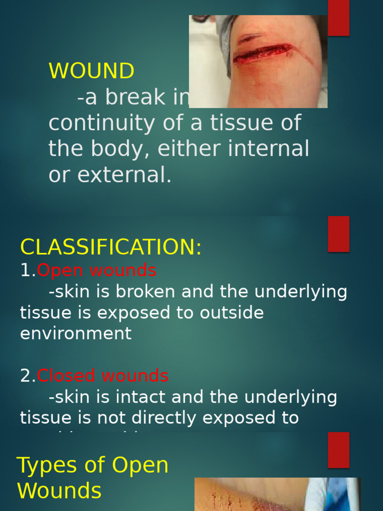 Types and Management of Wounds | PDF