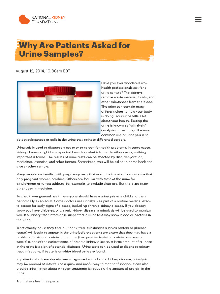 Why Are Patients Asked For Urine Samples?: August 12, 2014, 10:06am EDT ...