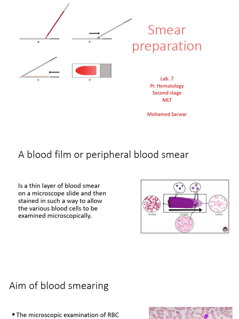 Pr. Hematology 7 Smear Preparation | PDF | Staining | Medical Specialties