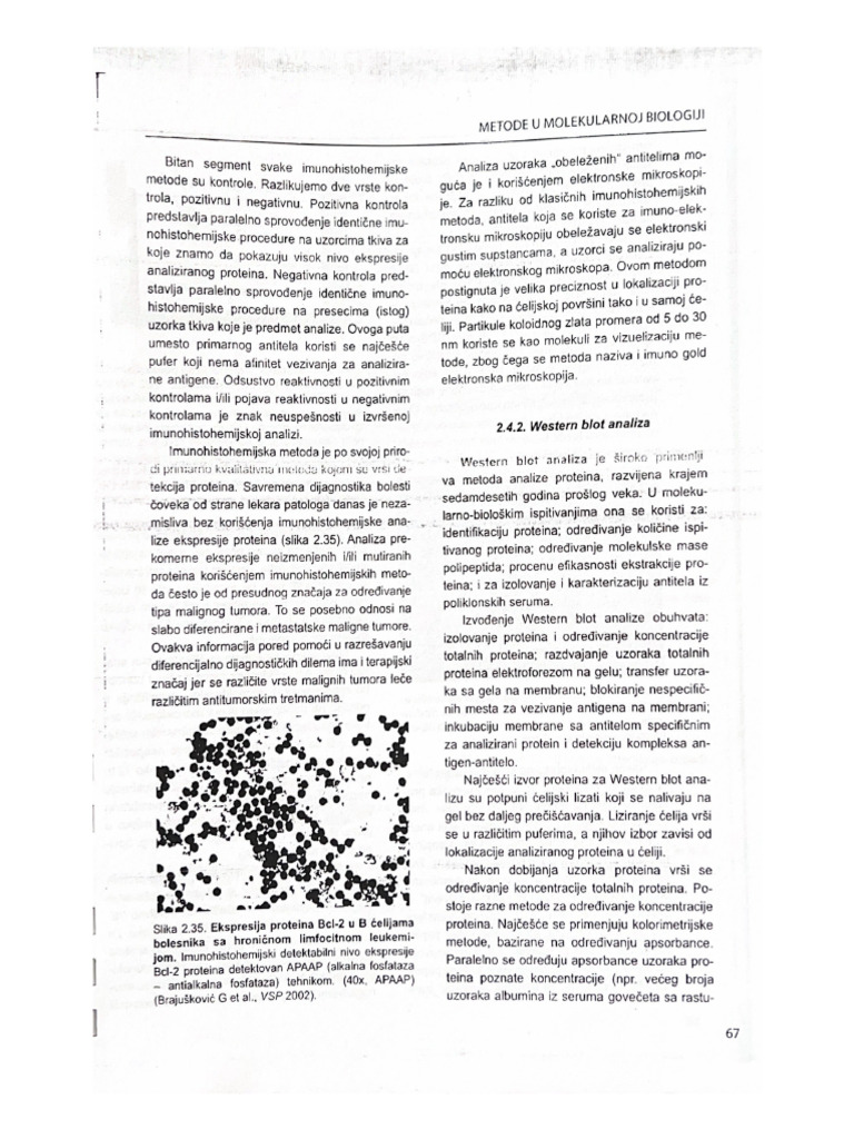 Western Blot | PDF