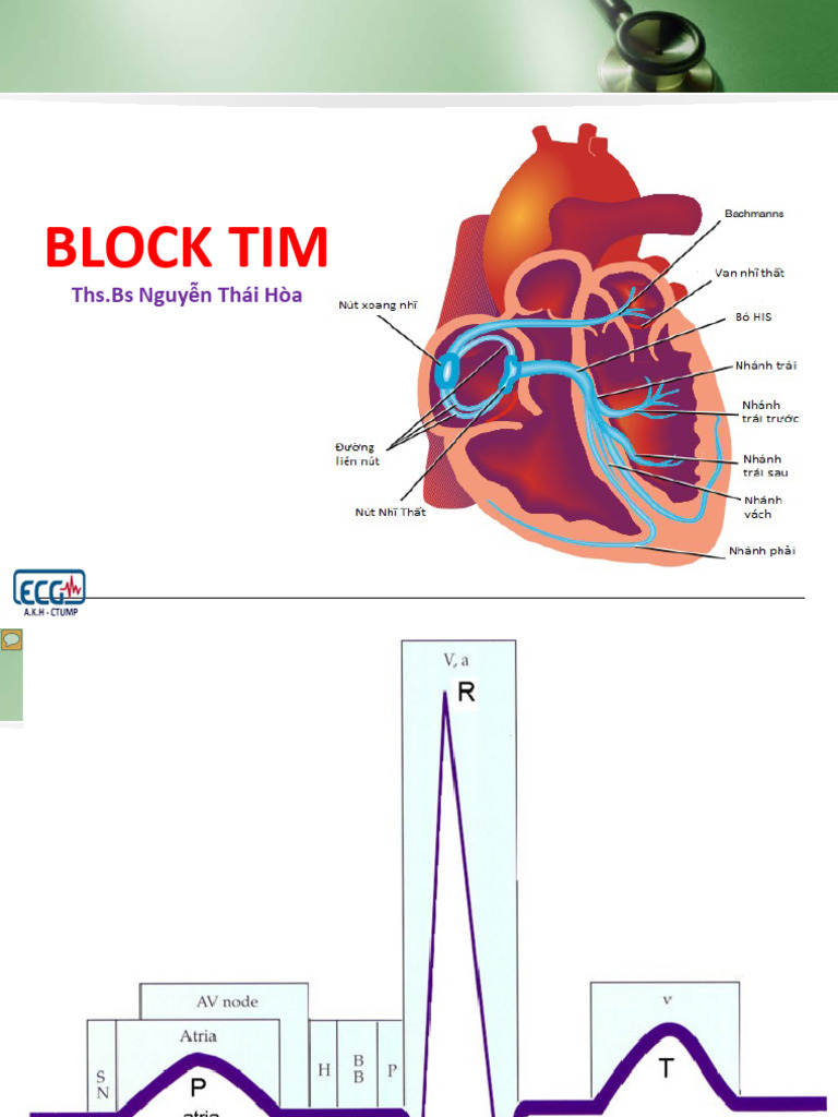 4. BLOCK HEART | PDF