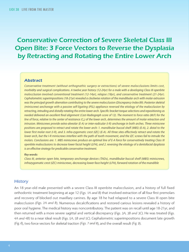 Class III Open Bite Correction | PDF | Orthodontics | Dental Anatomy