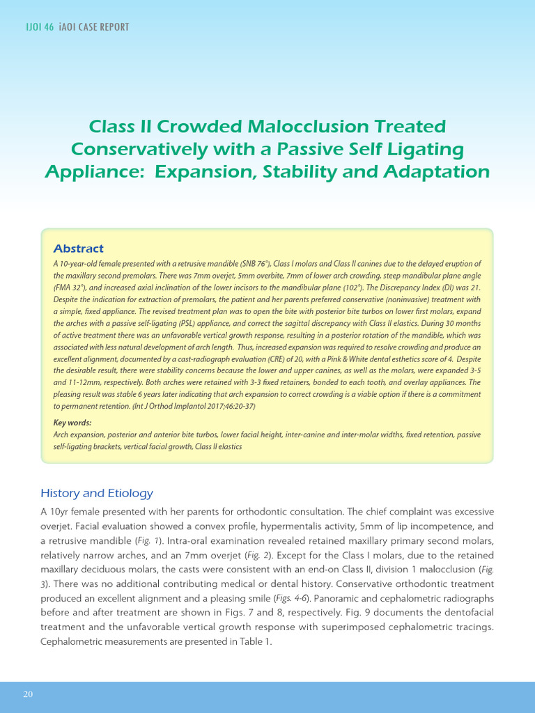 Class II Crowded Treatment | PDF | Orthodontics | Dentistry