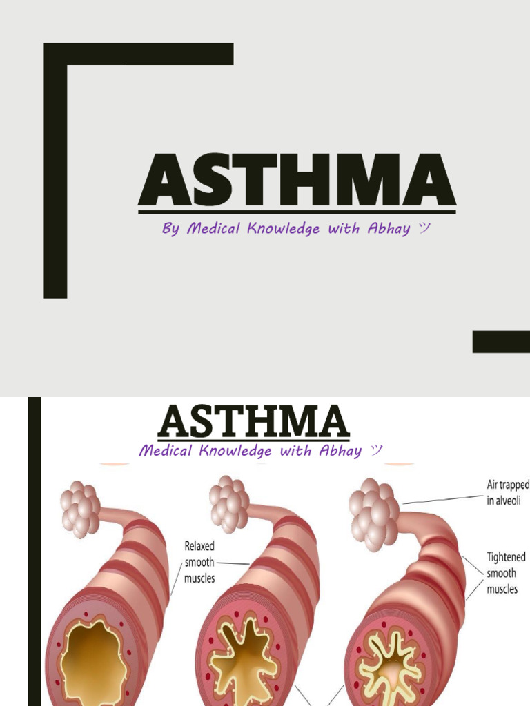 Asthma | PDF | Asthma | Immunology