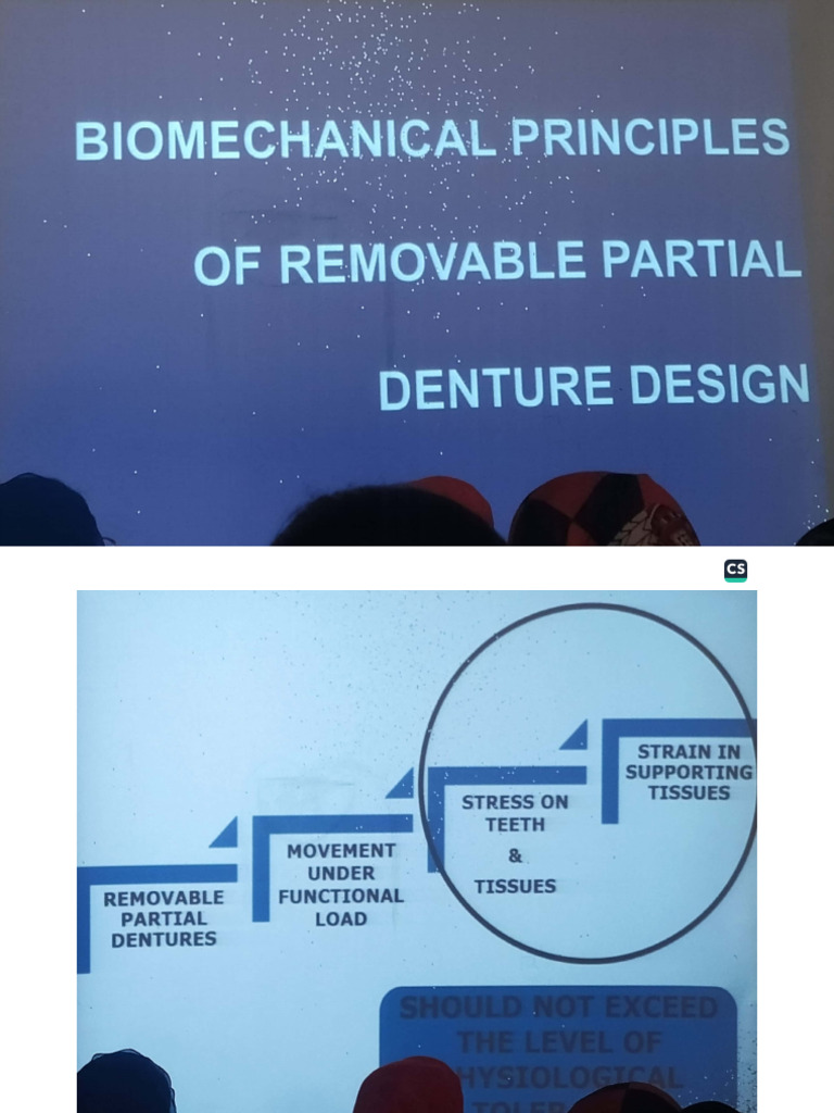 Biomechanical Principles of RPD (Dr. Attique) | PDF