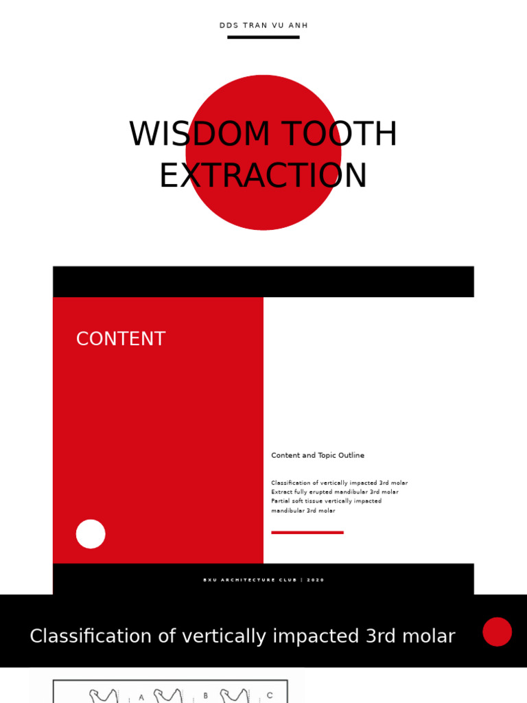 Vertically Erupted 3rd Molar | PDF | Animal Anatomy | Human Anatomy