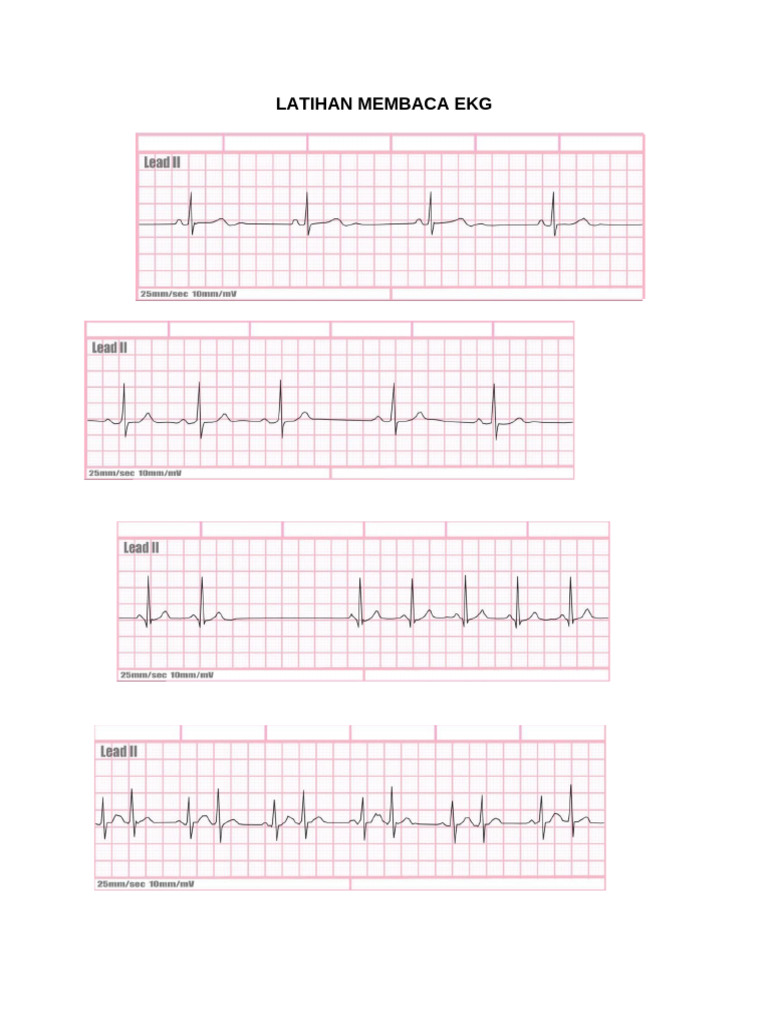 LATIHAN MEMBACA EKG (1) .Docx Ule | PDF