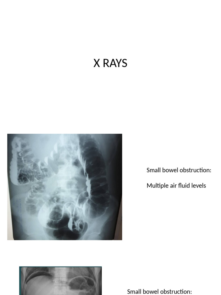 Xrays | PDF | Social Science | Wellness
