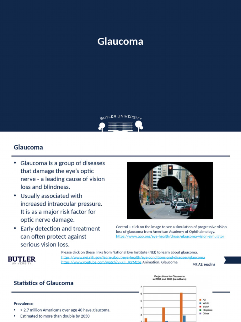 Glaucoma | PDF | Glaucoma | Drugs
