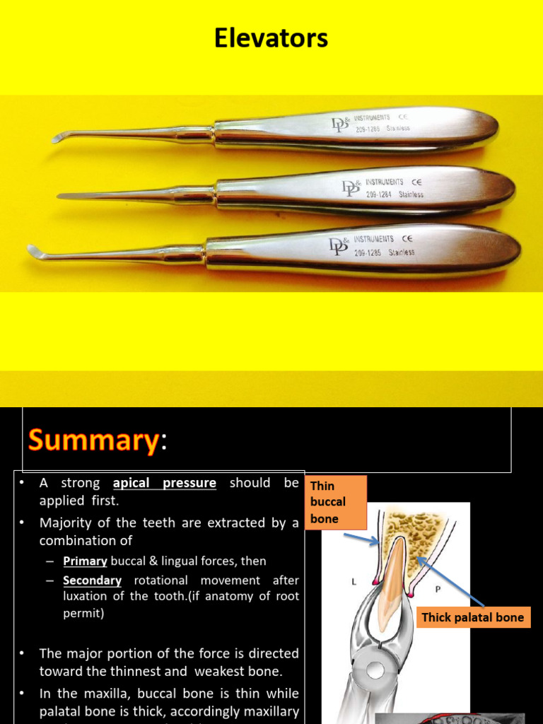 Principles of Dental Elevators and Forceps | PDF | Dental Anatomy ...