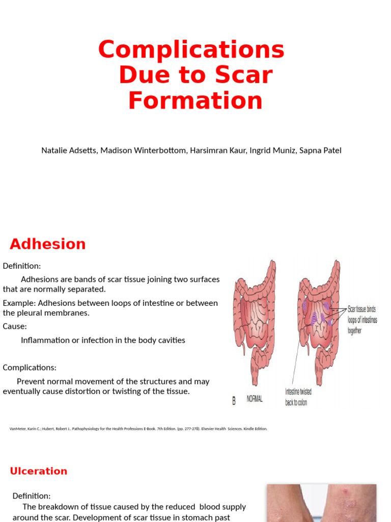 Activity 1 - Adhesion Due Scar Tissue | PDF | Social Science