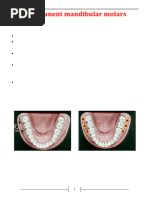 13 - Maxillary 2. Molar | PDF | Dental Anatomy | Tooth