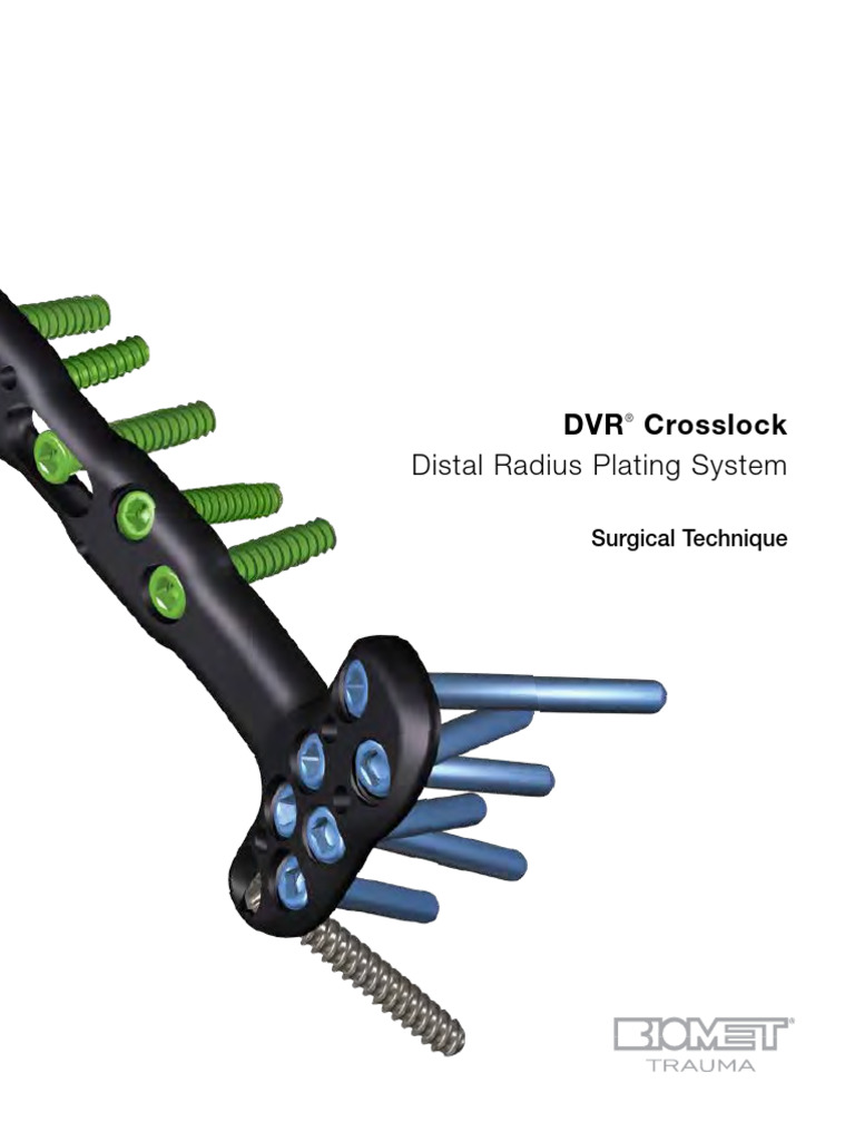 DVR Crosslock Distal Radius Plating System Surgical Technique | PDF ...