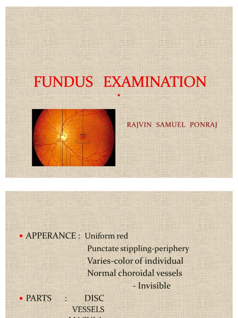 Fundus Examination Overview and Techniques | PDF | Science ...