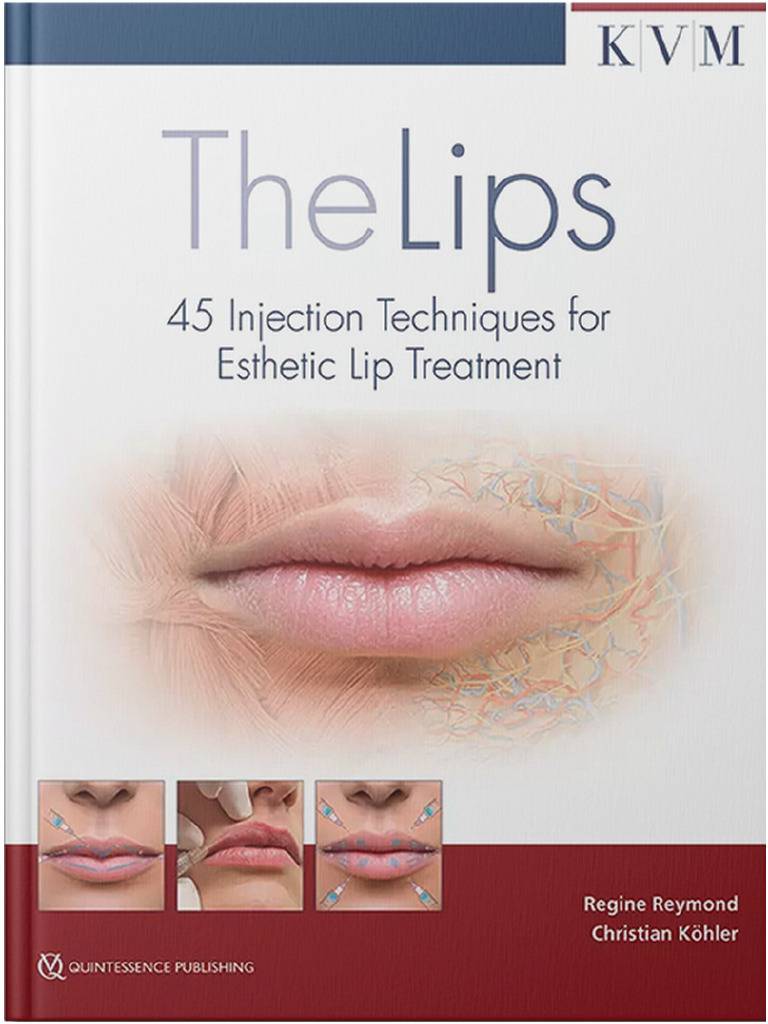 The Lips-45 Injection Techniques For Esthetic Lip Treatment-Removed ...