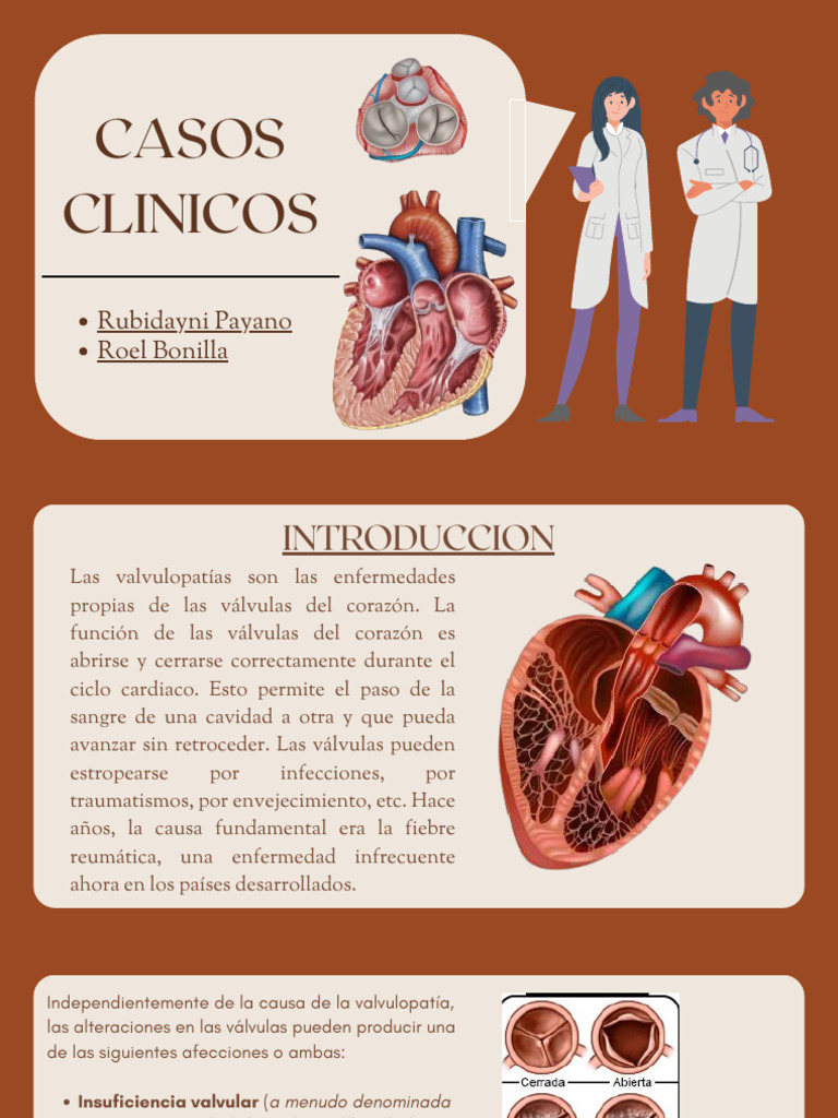 Copia de Levels of ASD Case Report by Slidesgo - PPTX - 20241106 ...