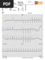 Valores Normales del ECG en Adultos | PDF | Corazón | Sistema ...
