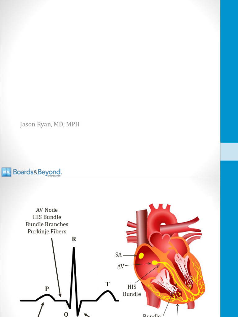 AV and Bundle Branch Blocks (Medicalstudyzone - Com) | PDF | Cardiovascular Diseases ...