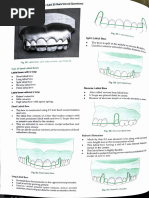 Lecture 15 Labial Bow and Springs | PDF | Orthodontics | Dentistry Branches