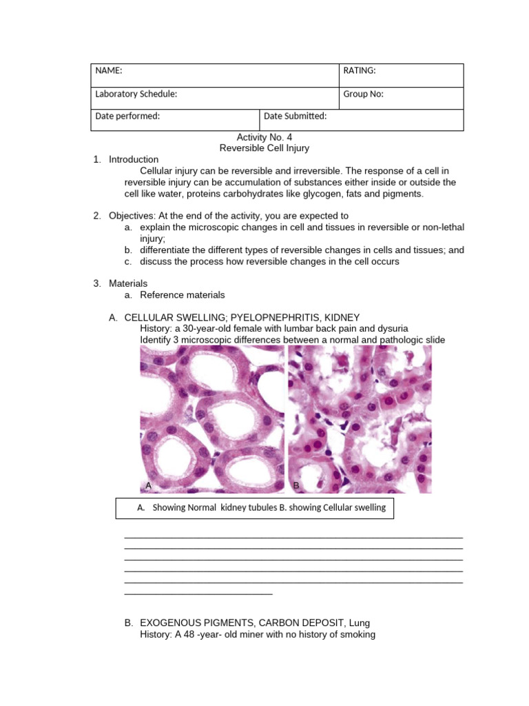 Reversible Cell Injury: Microscopic Changes | PDF | Edema | Cell (Biology)