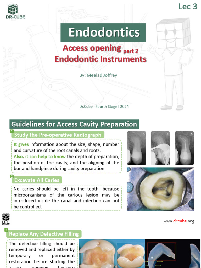 Endodo4 Lec 3 Access Opening Part 2 & Endodontic Instruments | PDF | Medical Specialties | Dentistry