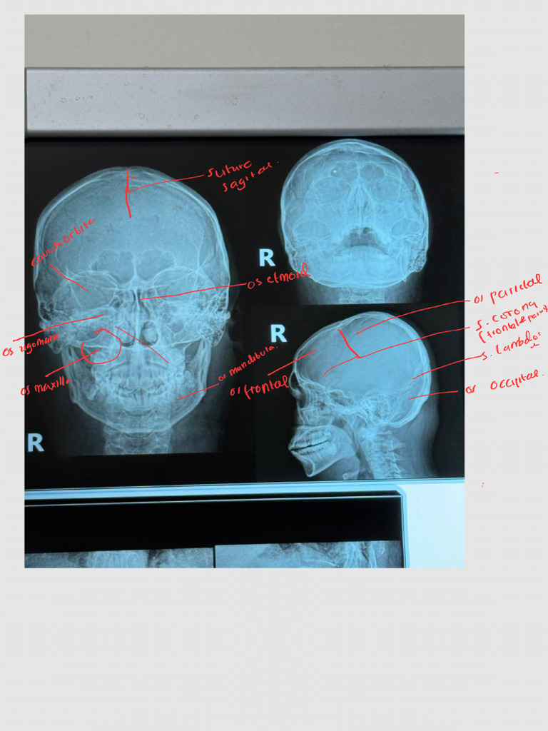 Skill Lab 4 Blok 14 Neurologi | PDF