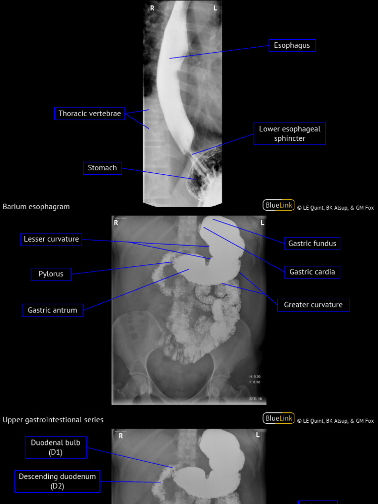 GI radiology BlueLink | PDF | Stomach | Large Intestine