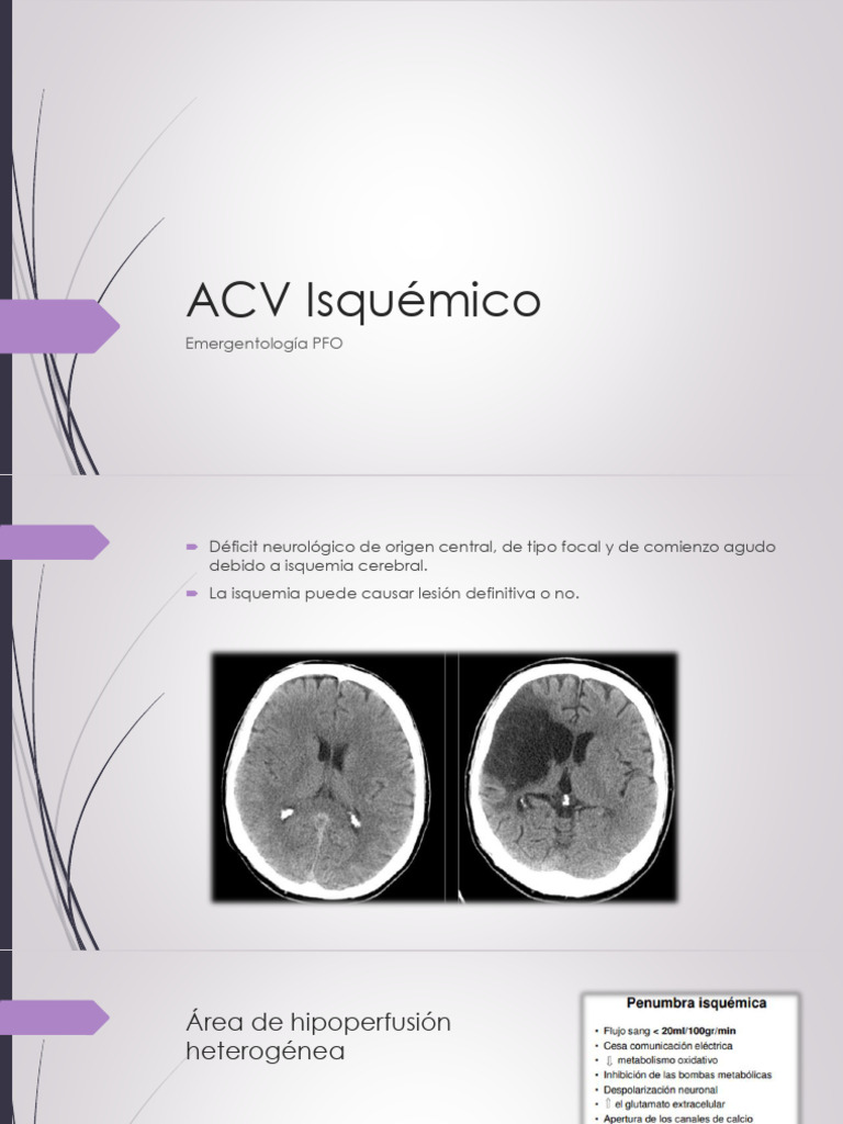 Manejo del ACV Isquémico en Emergencias | PDF | Ciencia y matemáticas