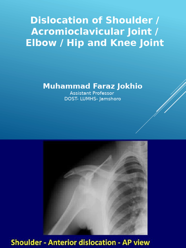 Dislocations MFJ | PDF