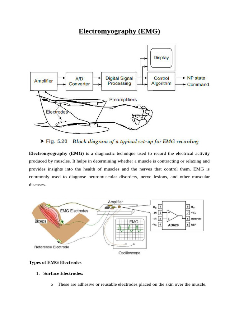 EMG: Diagnostic Tool for Muscles | PDF