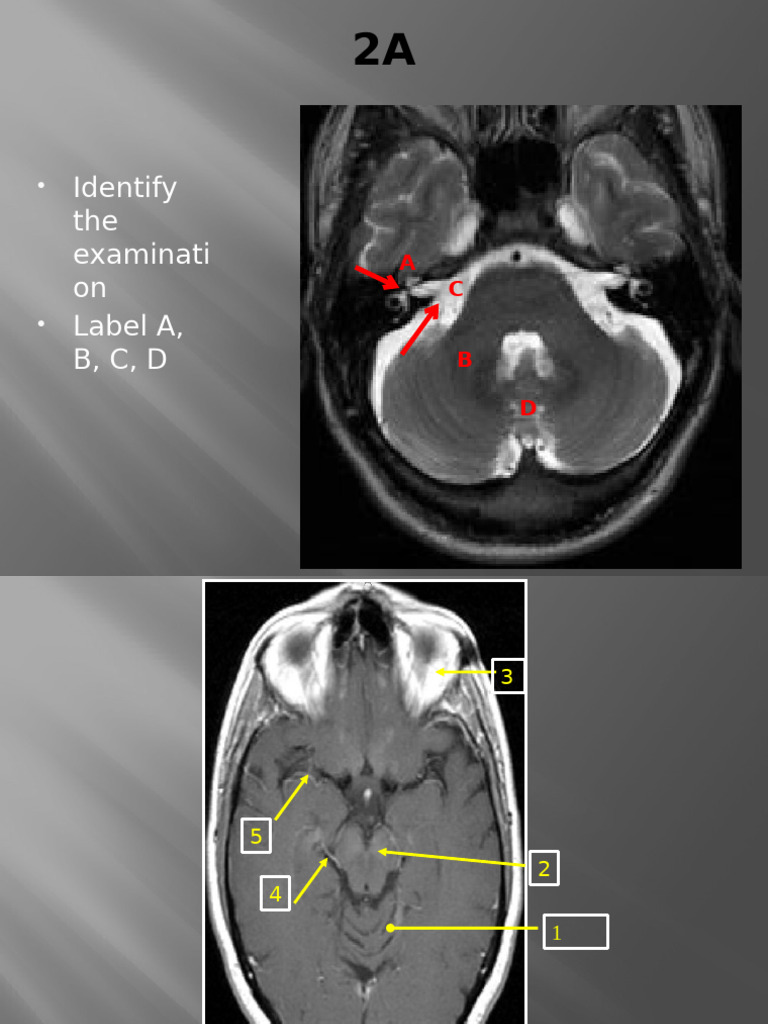 Anatomy Spots FINAL 2-1 | PDF | Vertebra | Vein