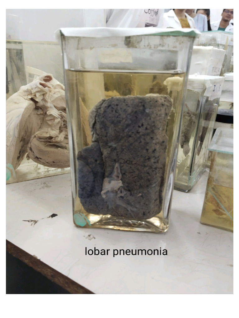 PATHO Specimen B-25 | PDF