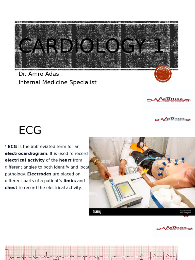 Cardio 1 ECG and Arrythmia 1 Lyst1718302292293 | PDF | Electrocardiography | Heart