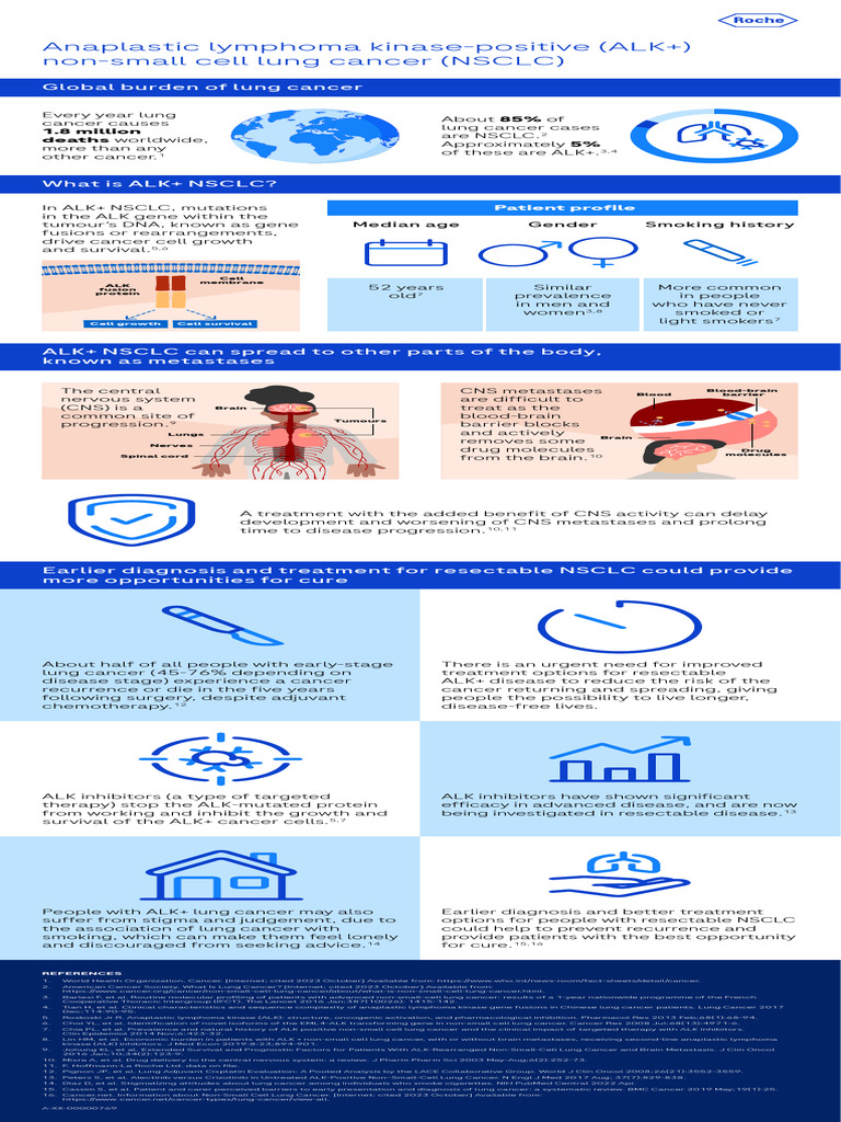 Alk Nsclc Infographic | PDF | Cancer | Lung Cancer