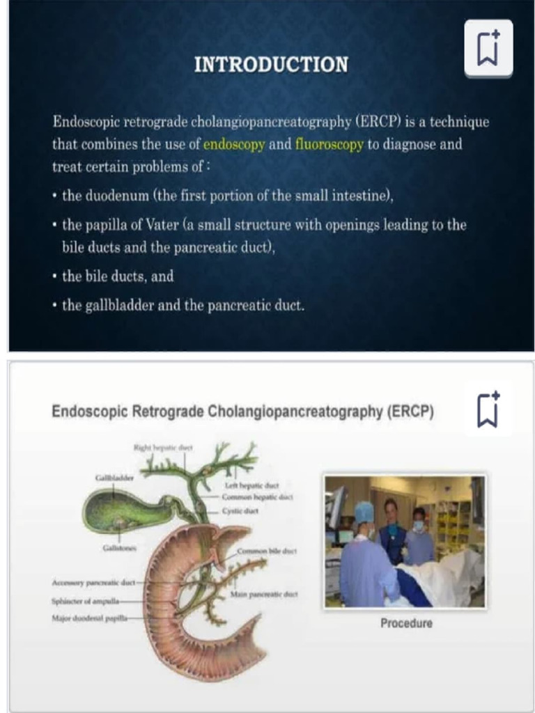 Ercp | PDF | Digestive System | Gastroenterology